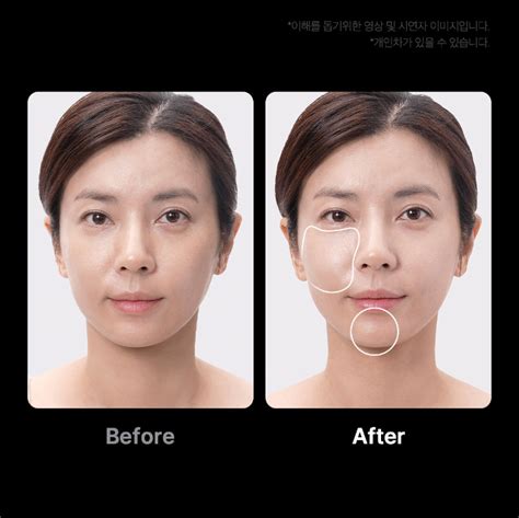 Medicube Age R Booster Pro Derma Roller Systems Sa