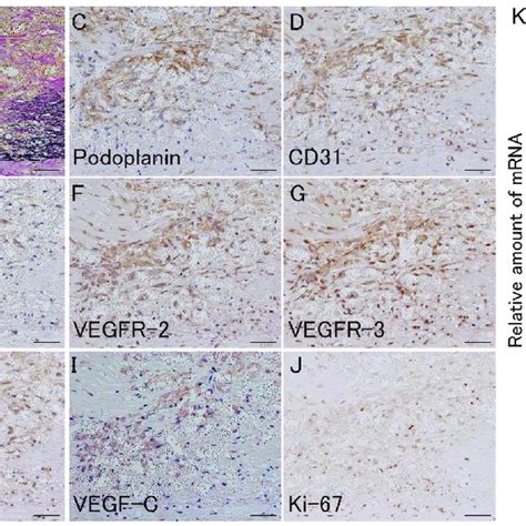 Evg Staining Of Normal Aorta A And Abdominal Aortic Aneurysm Aaa