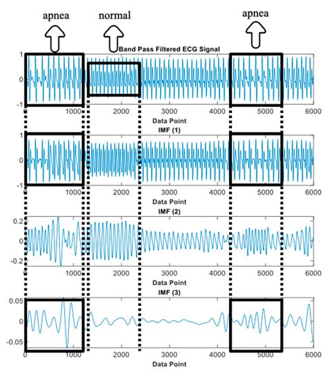 Life Free Full Text A Deep Learning Framework For Automatic Sleep