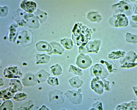 Epi Síntomas Clave Y Cómo Proteger Tu Salud Una Salud PanamÁ