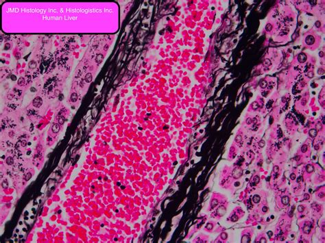 Reticular Connective Tissue Under Microscope At Terry Swenson Blog