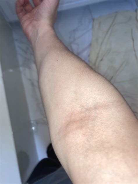 Skin Concern Rskincareaddiction