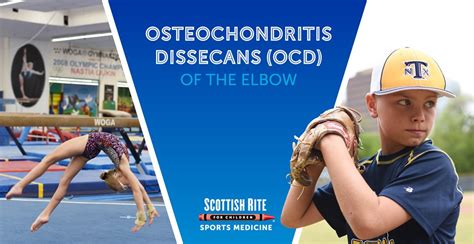 Osteochondritis Dissecans Ocd In The Elbow Pediatric Orthopedic