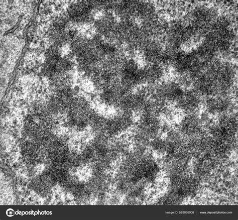 Nucleolus Micrograph
