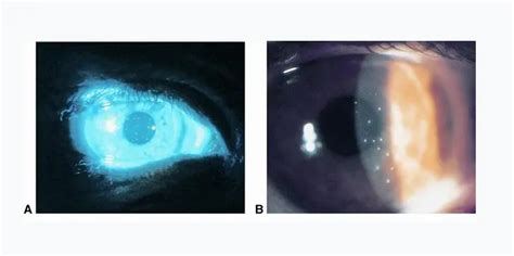 For Ophthalmologists American Academy Of Ophthalmology