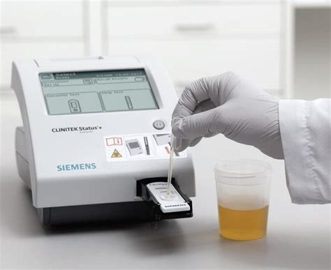 Achieving Clinical Performance And Sensitivity Criteria With Clinitest