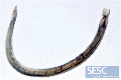 Strongylus Vulgaris Morphology