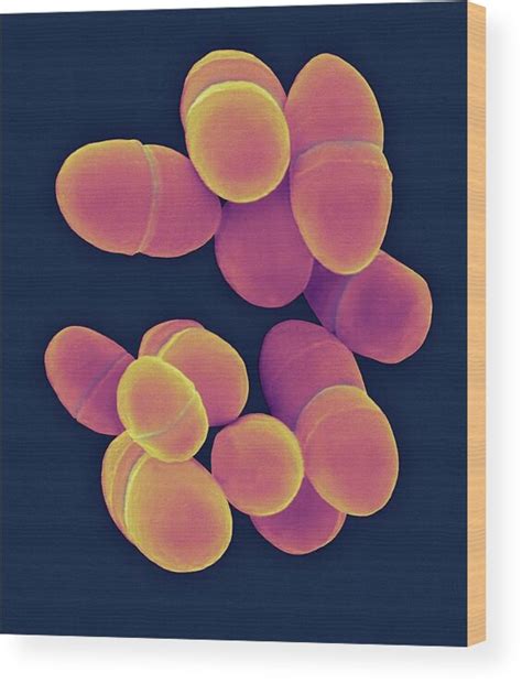 Streptococcus Lactis Gram Stain