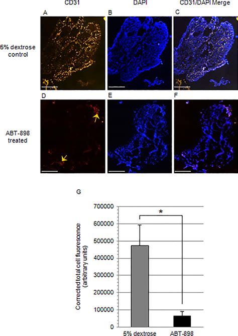 Cd31 Endothelial Cells Within Human Endometriotic Lesions Download