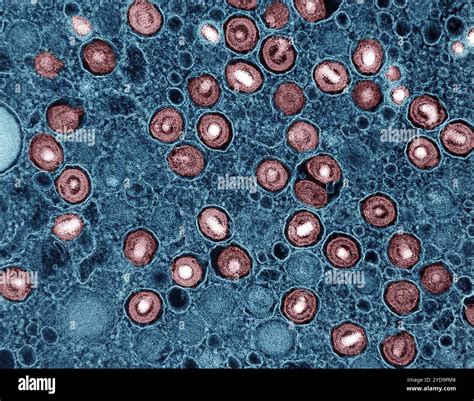 Transmission Electron Micrograph Of Cytomegalovirus Cmv Particles Red