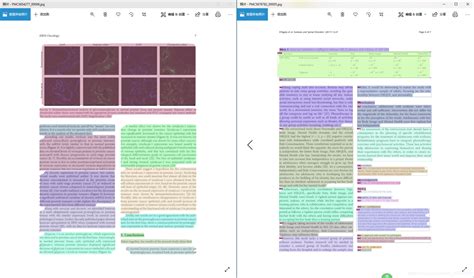 基于mask rcnn的版面分析 maskrcnn版面分析 csdn博客