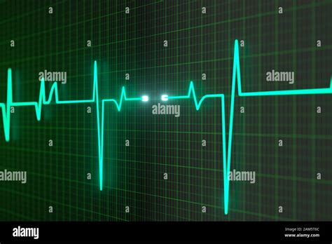 Heartbeat Monitor Line
