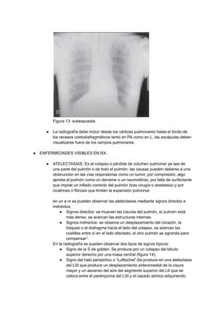 Conocimientobasicosdeunarxdetorax Doc Pdf