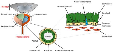 Cellular And Molecular Progression Of Prostate Cancer Models For Basic