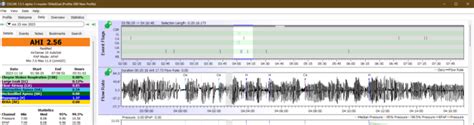 Oscar The Open Source Cpap Analysis Reporter