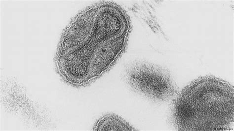 Smallpox Virus Eradicated 40 Years Ago Dw 05072020