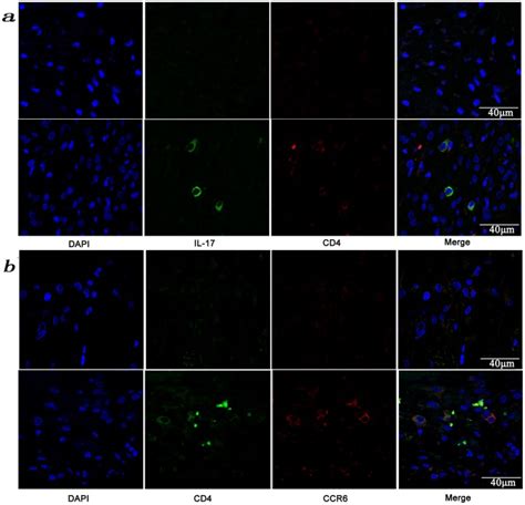 Ccl20 Secretion From The Nucleus Pulposus Improves The Recruitment Of