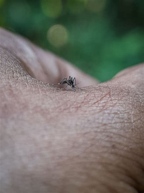 Mosquitoes Are Biting Human Skin Stock Image Image Of Malaria