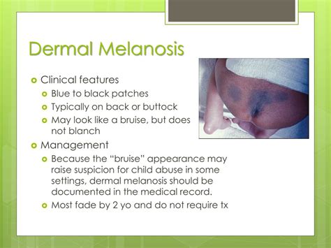 Ppt Dermatologic Conditions Of The Neonate Powerpoint Presentation
