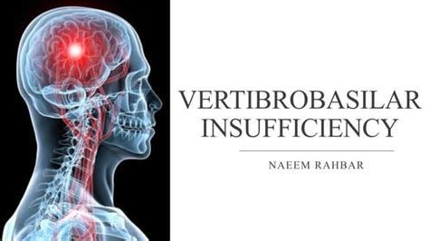 Vertebrobasilar Insufficiency Bow Hunters Syndrome An Unusual Case