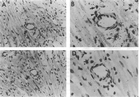 In Situ Localization Of Galgainac Macrophage Lectin Mrna In Cardiac