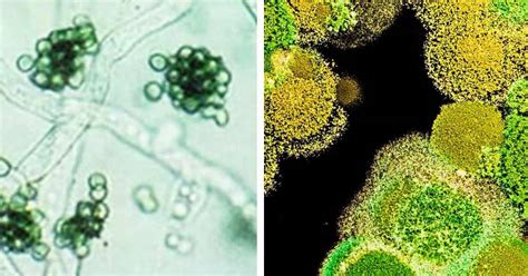 कृषि और बागवानी में ट्राइकोडर्मा के चमत्कारिक फायदे Agro India