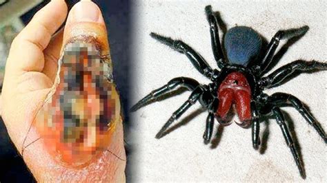 Dodelijkste Spinnenbeet Ter Wereld