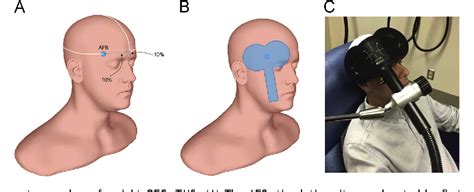 Figure 1 From 1hz Rtms Of The Right Orbitofrontal Cortex For Major