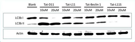 Our Top Cited Lc3b Antibody Novus Biologicals