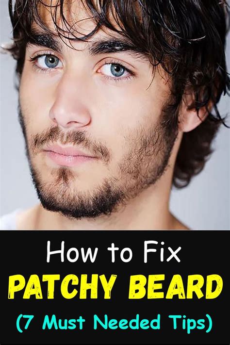Struggling With Beard Balding Heres How To Effectively Fix A Patchy