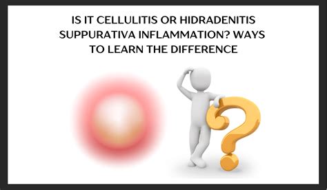 Is It Cellulitis Or Hidradenitis Suppurativa Inflammation