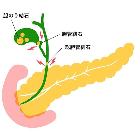 Vol1 胆道・膵臓疾患のスペシャリスト 消化器内科医師 加藤 博也 岡山市立市民病院 Webマガジン