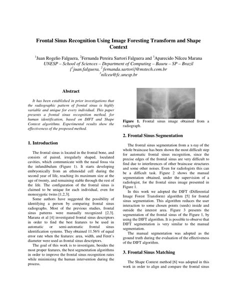 Pdf Frontal Sinus Recognition Using Image Foresting Transform And