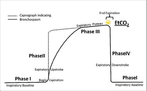 End Tidal Co2 Monitoring Waveforms Maranda Juarez