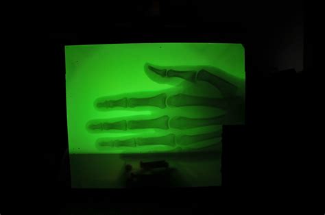 A Diy X Ray Machine Yes A Diy X Ray Machine By Cameron Coward Medium
