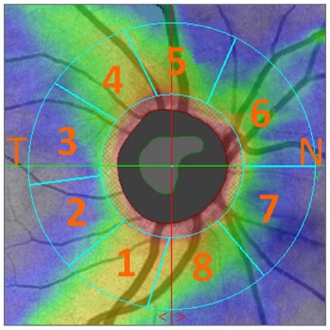 Designation Of Each Peripapillary Segment In Which Rnfl And Vd Were