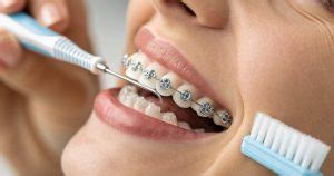 How To Brush Your Teeth With Braces Complete Guide