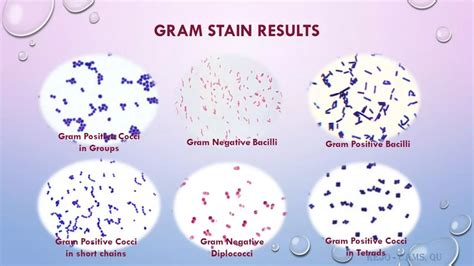 Different Staining Techniques In Bacteriology Ppt