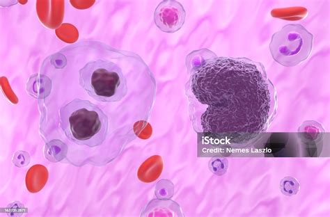 Limfoma Hodgkin Hl Dan Limfoma Nonhodgkin Sel Nhl Dalam Aliran Darah Tampilan Closeup Ilustrasi Limfoma Hodgkin Hl Dan Limfoma Nonhodgkin Sel Nhl Dalam Aliran Darah Tampilan Closeup Ilustrasi