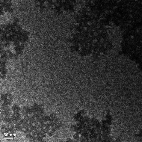 We Are Facing Lots Of Problem While Doing Normal Tem In Rainy Season