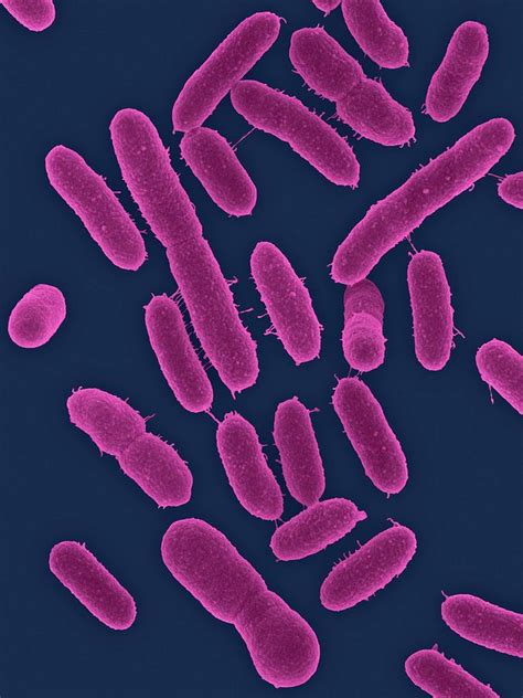 Sphingobacterium Psychroaquaticum 1 By Dennis Kunkel Microscopy