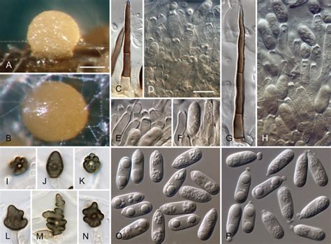 Colletotrichum Torulosum Ab Conidiomata C Setae Df