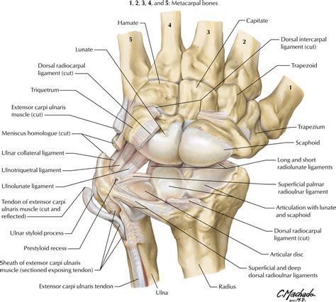 Triangular Fibrocartilage Complex An Anatomical And Medical