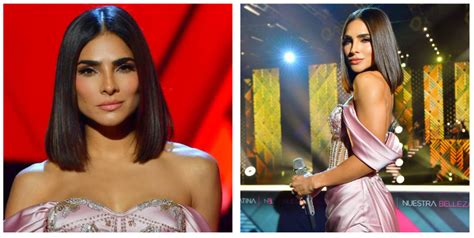 Alejandra Espinoza Antes Y Despues De Cirugia