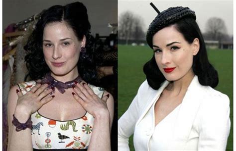 Dita Von Teeses Plastic Surgery What We Know So Far Famous Plastic