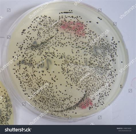 Staphylococcus Bacteria Petri Dish