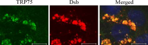 Immunofluorescent Confocal Microscopy Of E Chaffeensis Infected Thp 1