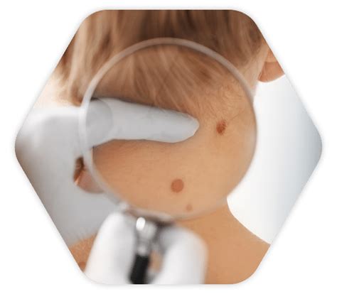Dermatology Treatment Overview Cosmetic And Medical