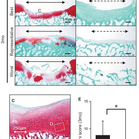 Histological Analyses Of Cartilage Defect Transplanted With Mscs