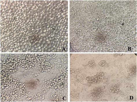 Cytopathic Effects In C636 Cells Infected With Zikv And Not Infected